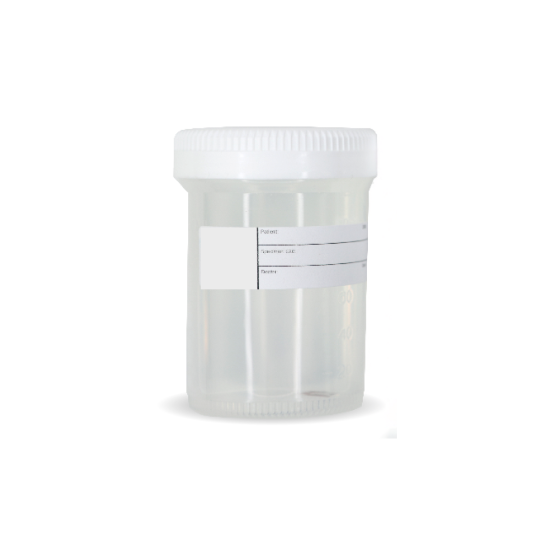 (Non-GYN/Urine) Single Jar Cytology Collection Kit – Lumea